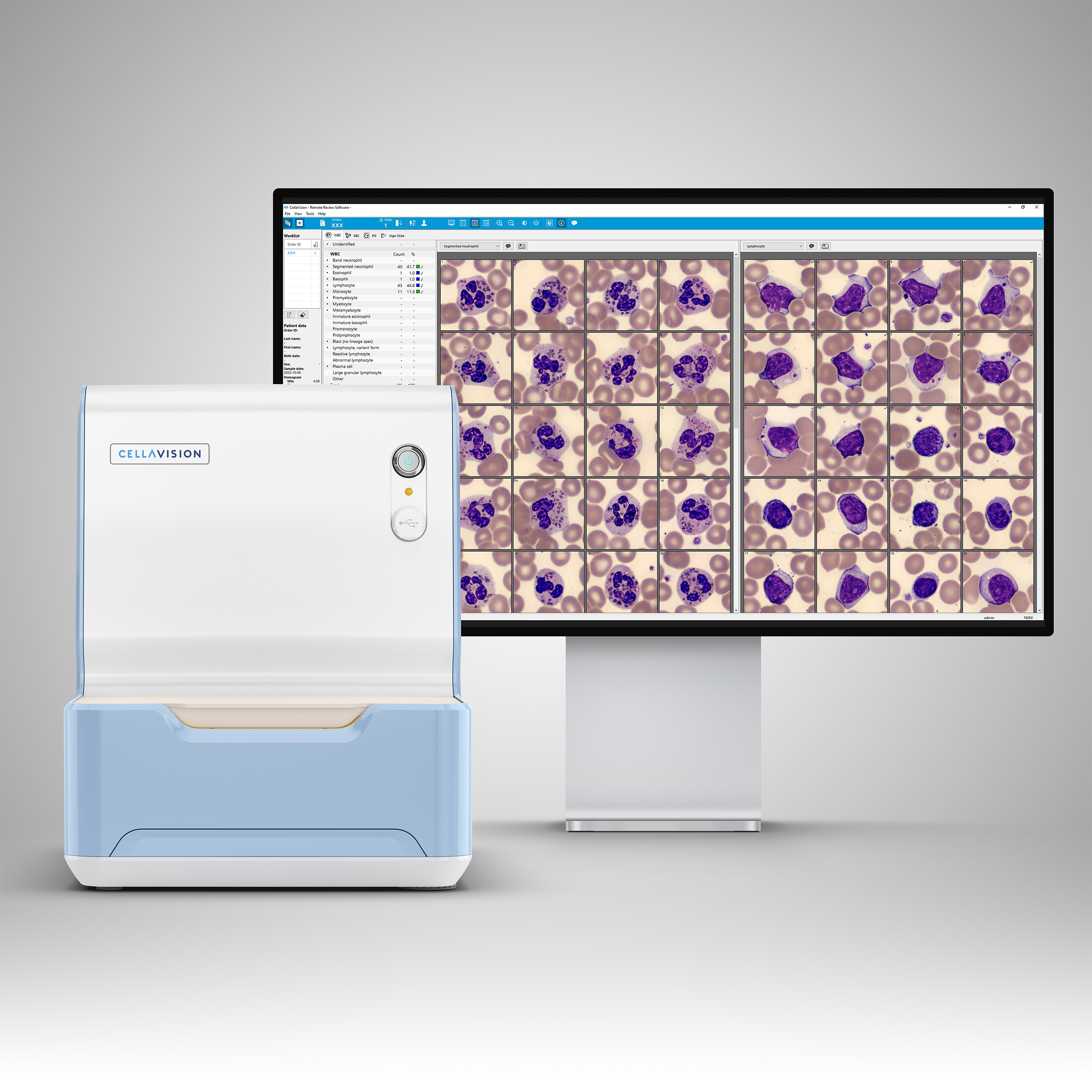 Monthly Cell Challenge #2 / 2025 | CellaVision